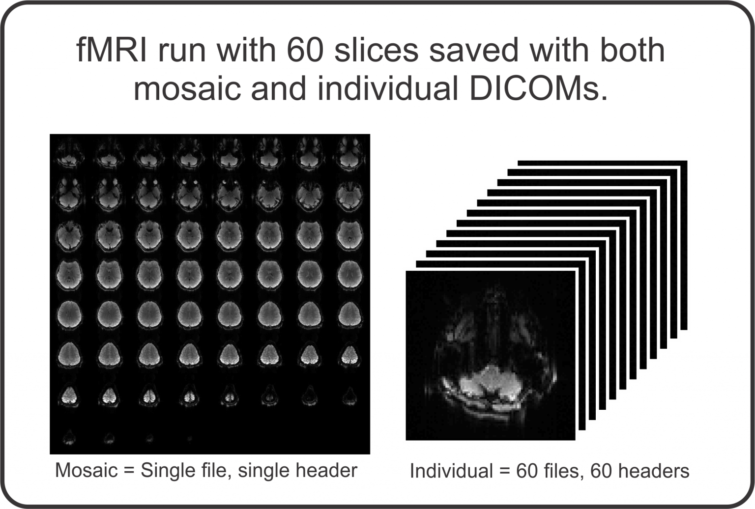 Siemens Enhanced DICOMs – Center for Advanced Human Brain Imaging Research