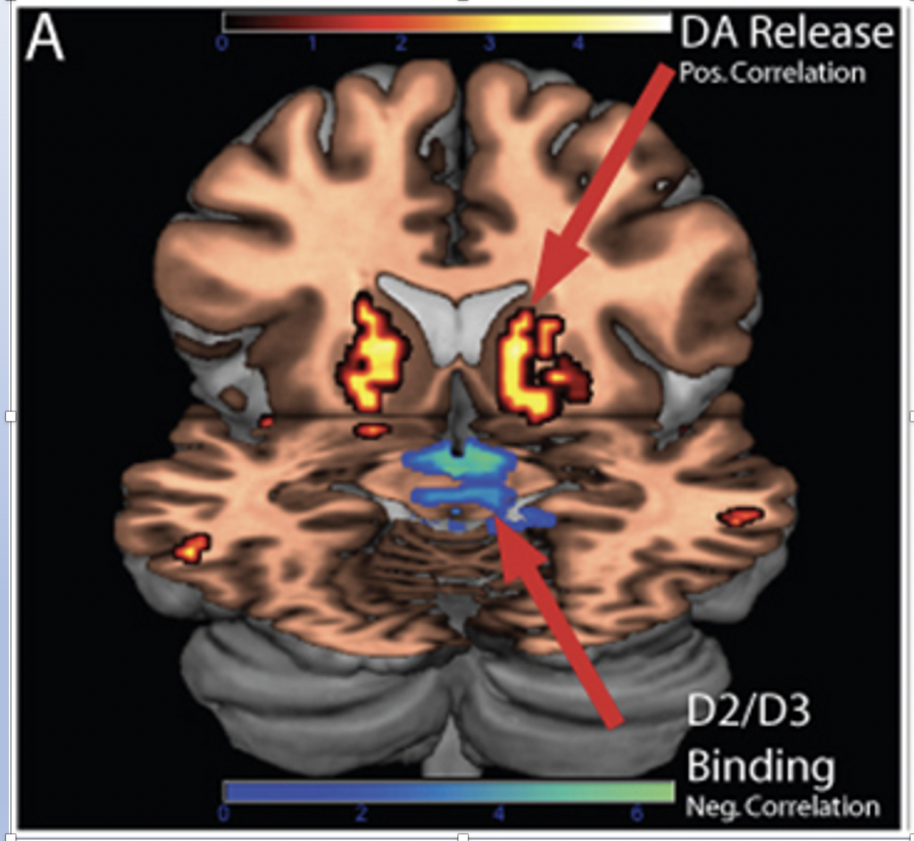 Research – David Zald