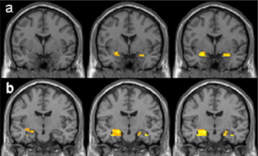 Research – David Zald