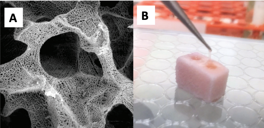 Bone Regeneration – Laboratory for Biomaterials Research