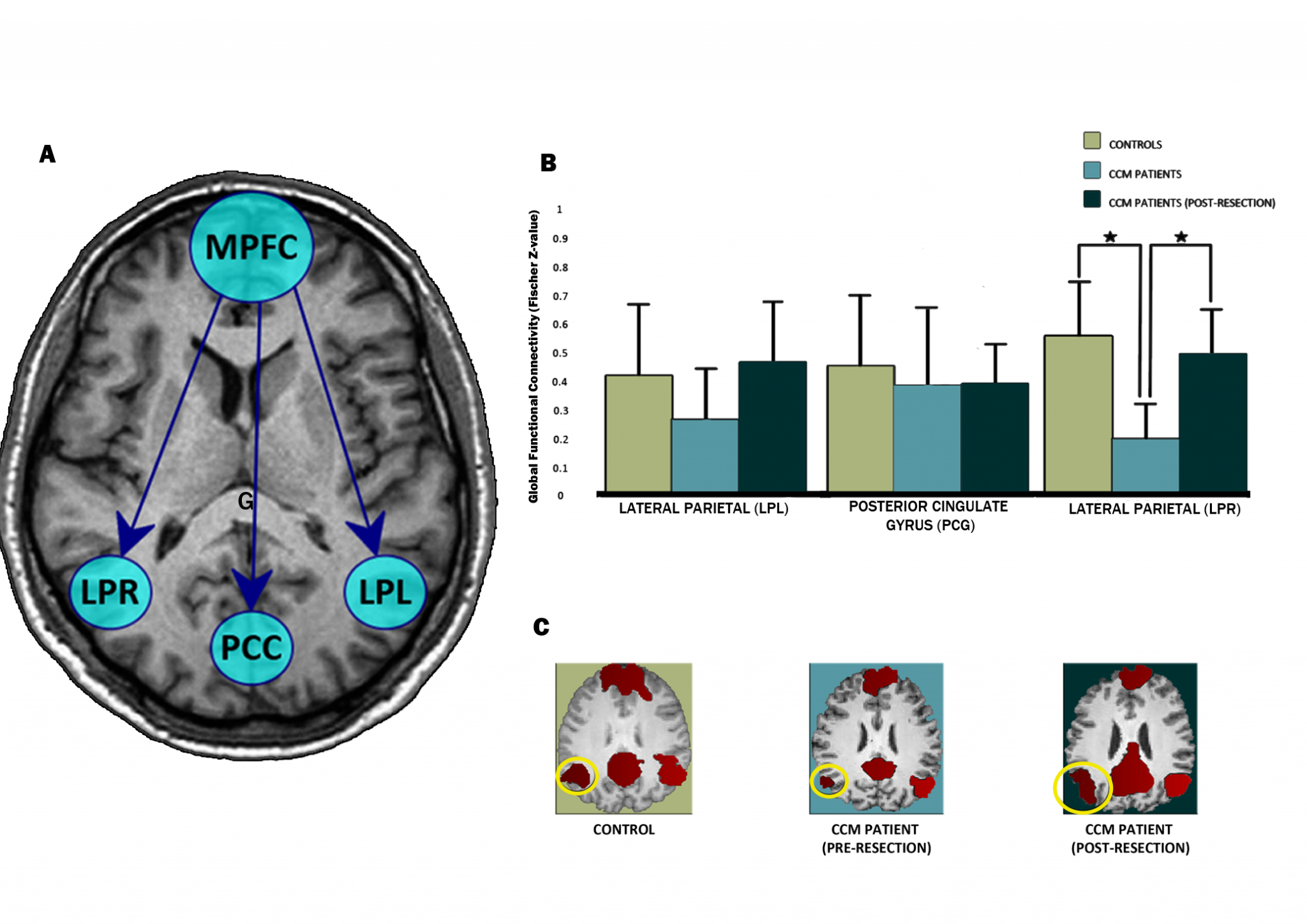Brain Connectivity and Neuroimaging – Neurological Surgery